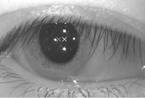 Robust Eye Tracking Methods