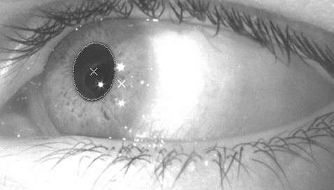 Robust Eye Tracking Methods